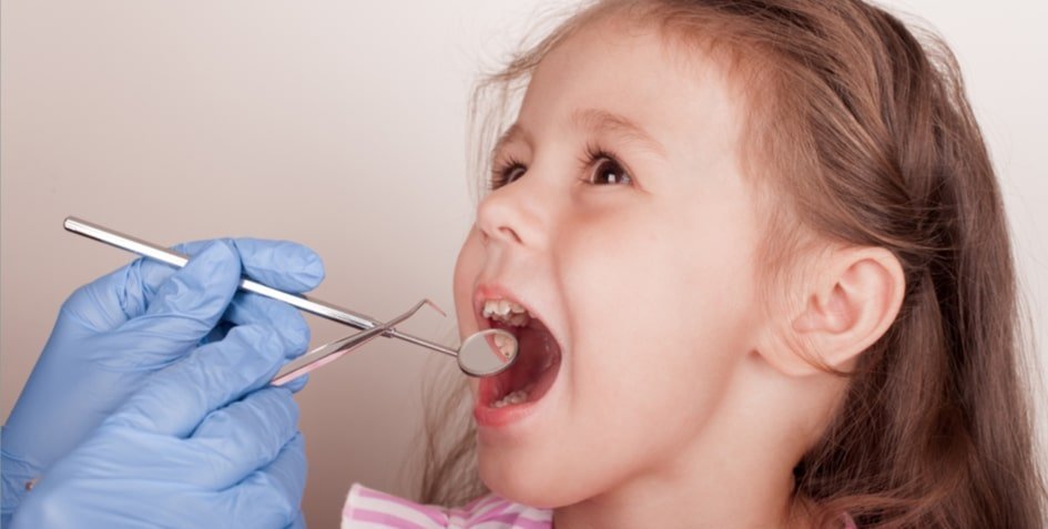 Take care of ginvivitis in children | Rhône Dental Clinic